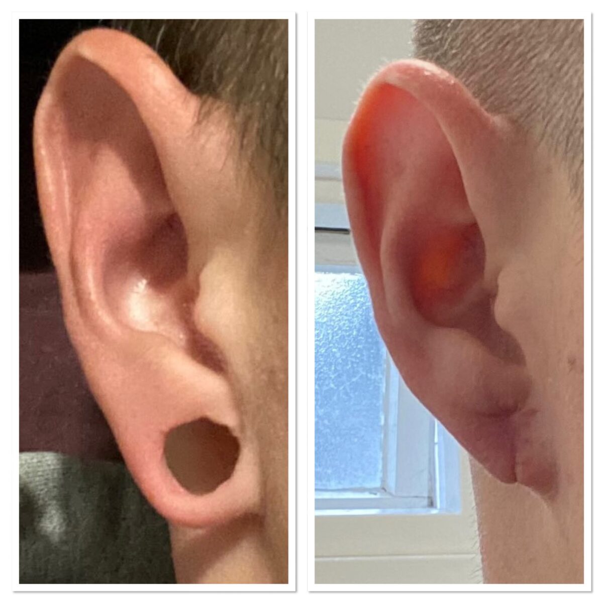 Minor Surgery | Medical Treatments | Satin Healthcare